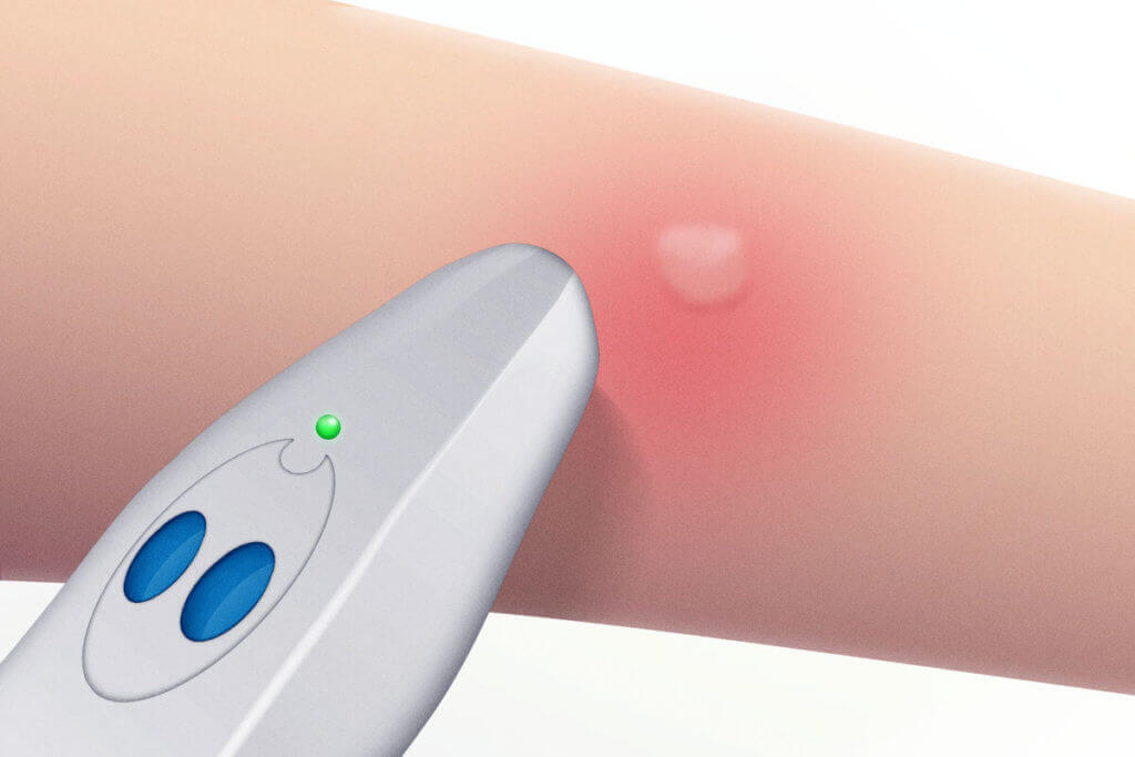 insect bite healer review & comparison 2022 | FinalCheck